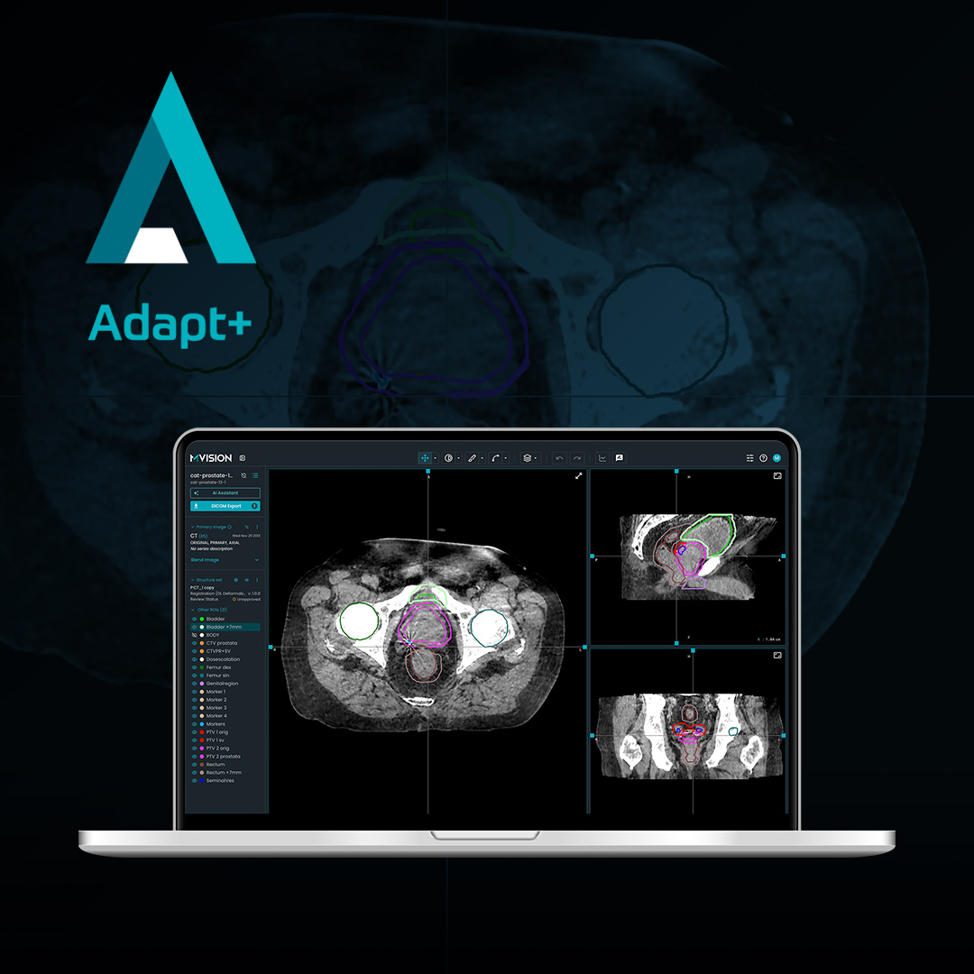 Adapt+ | Adaptive AI-Based Contour Propagation | MVision AI