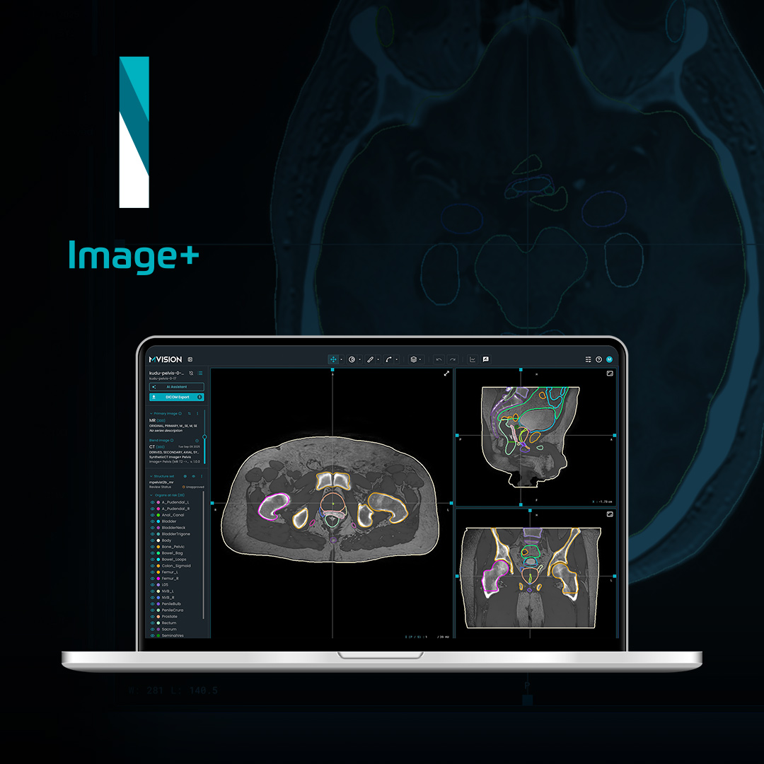 Image+ | Powering Radiotherapy With Synthetic Imaging | MVision AI