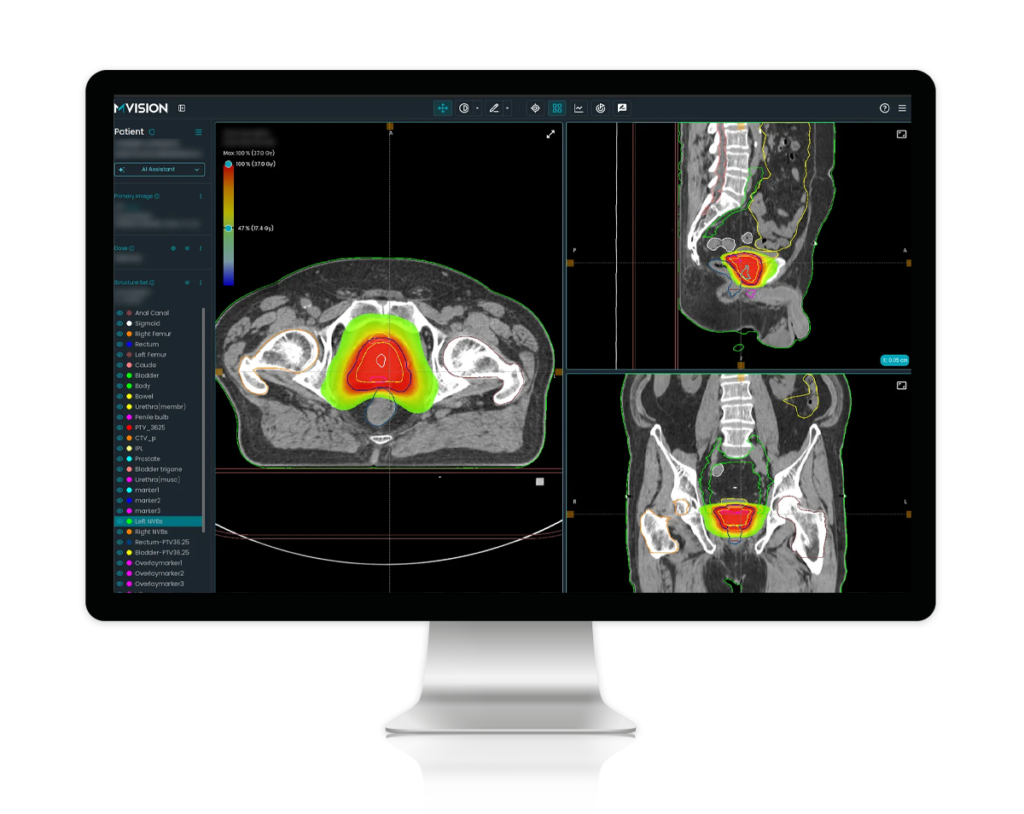 Dose+ | AI-powered dose prediction | MVision AI